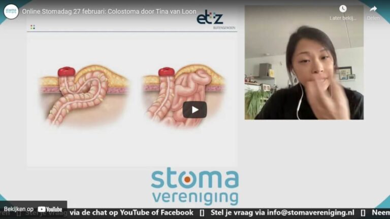 De impact van een colostoma op je dagelijks leven - Stomavereniging